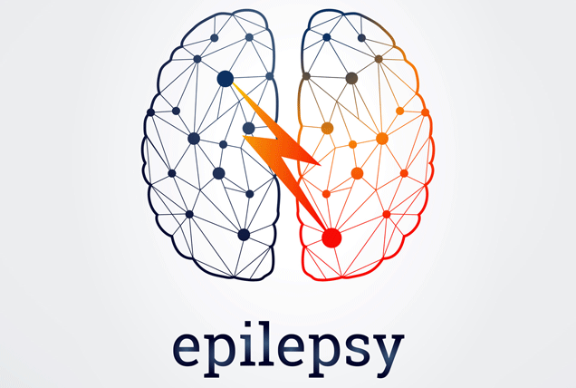 Epilepsy, Seizures, Convulsions | German Neuroscience Center Dubai